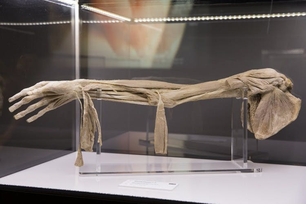 Human Bodies exhibition tickets with audio guide - KKday